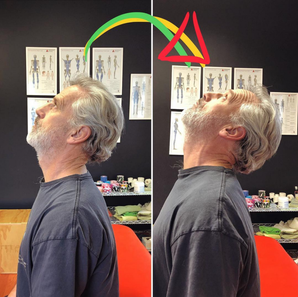 Mckenzie Method - Neck Pain! - Total Physical Therapy