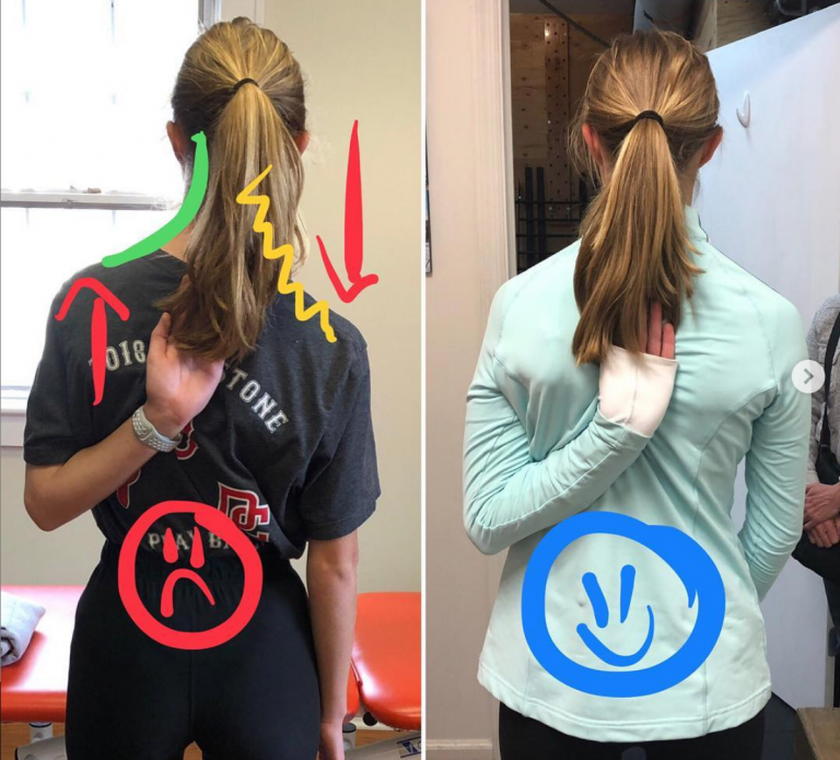 Neck Pain gone via Hips, Pelvis & feet! - Total Physical Therapy