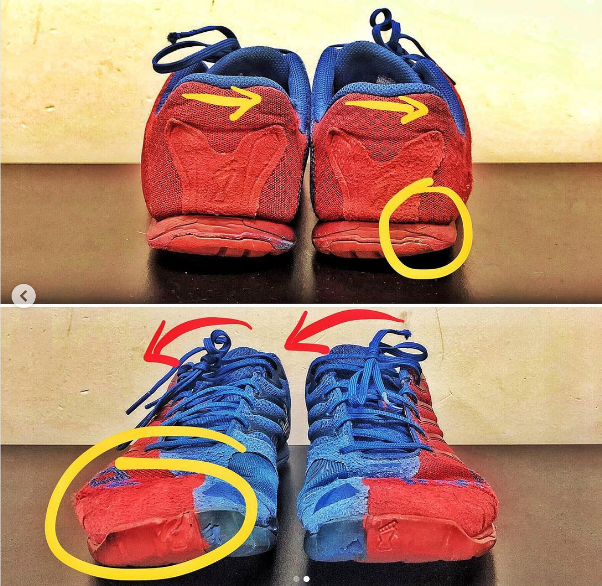 SNEAKER WEAR PATTERN Is DYSFUNCTION Total Physical Therapy SNEAKER WEAR PATTERN Is DYSFUNCTION Total Physical Therapy