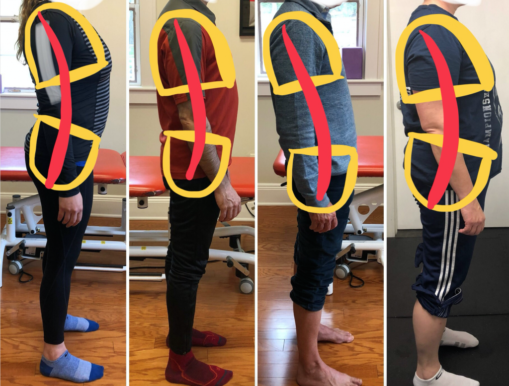 What's your Spinal Stability Strategy? - Total Physical Therapy